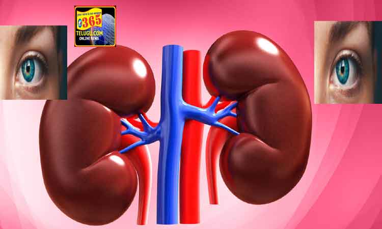 Can eyes be related to kidney failure?